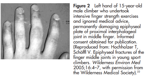 Parenting Beta: Injuries in Young Climbers - Sender One Climbing